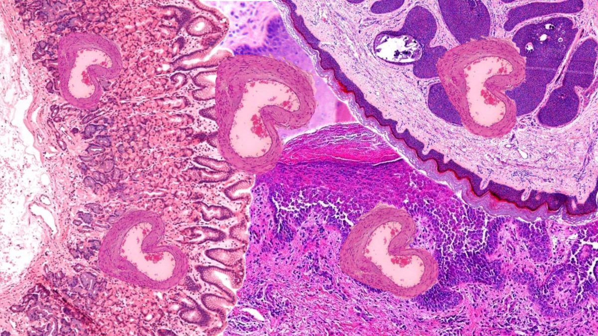 Coloring the Canvas : Essential Stains of Pathology (Part 1) – THE ...